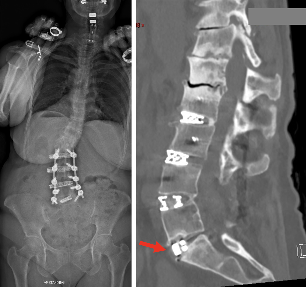 ALIF - Dr. Justin Smith